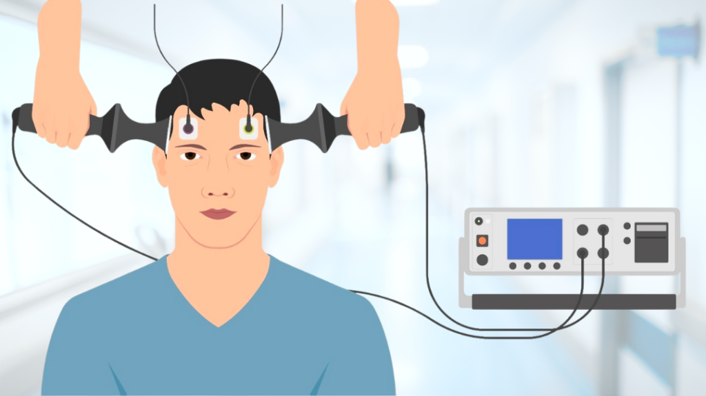 Brain Stimulation Treatments: Illuminating Paths of Hope for Mental Health